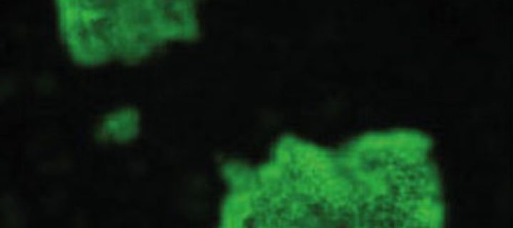 Bartonelosis: ¿Qué sabemos? ¿Qué podemos hacer? – VetPraxis