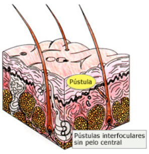 Qué Causa El Impétigo En Los Perros